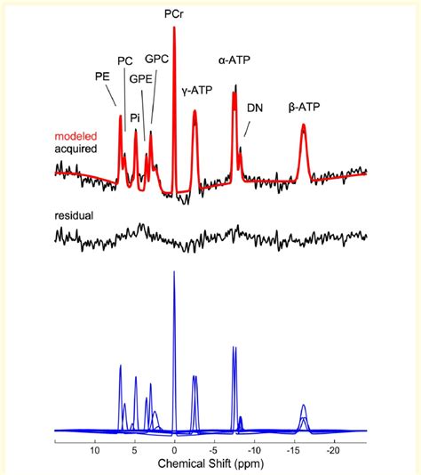 Example Of A Quantified In Vivo ³¹p Mrs Spectrum Extracted From The