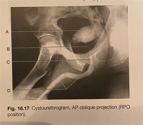 Chapter 16 Anatomy Cystourethrogram Ap Oblique Projection Rpo Position Flashcards Quizlet