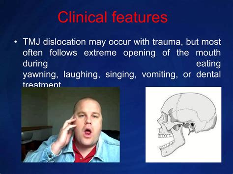 Clinical Features Of Tmj Dislocation Ppt