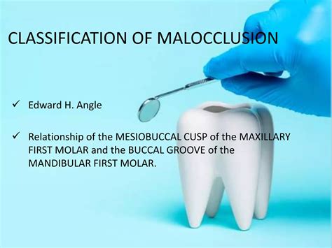 Classification Of Malocclusion Pptx