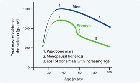 How To Do By Vinod Osteoporosis Peak Bone Mass In Women