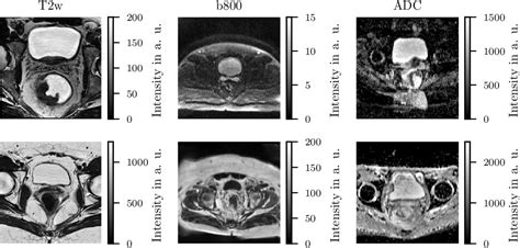 Figure 1 From Comparison Of Image Normalization Methods For Multi Site