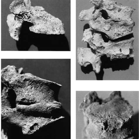 Molecular Sex Identification Of The Ancient Vertebral Bone Samples From Download Scientific
