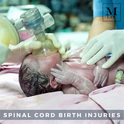 Spinal Cord Birth Injuries Merson Law Pllc