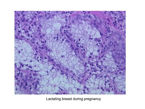Cell Injury Necrosisppttypes Of Necrosis Morphology Ppt