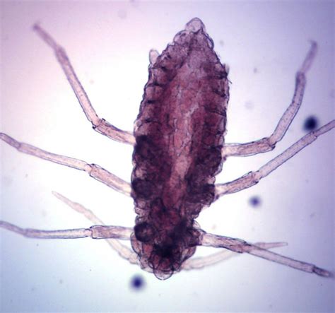 Aphid Wm Microscope Slide Southern Biological