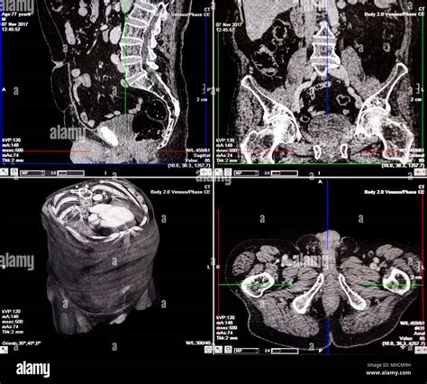 Risonanza Magnetica Imaging Mri Immagini E Fotografie Stock Ad Alta
