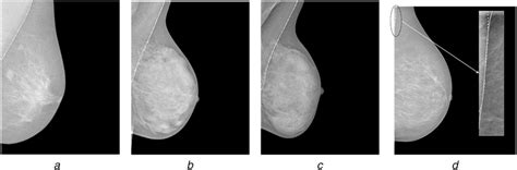 Results Of Proposed Pmb Detection Algorithm Shown By Solid Linealong Download Scientific