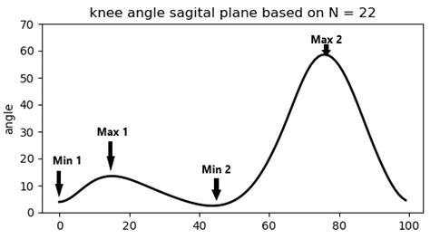 Sofigait—a Wireless Inertial Sensor Based Gait Sonification System