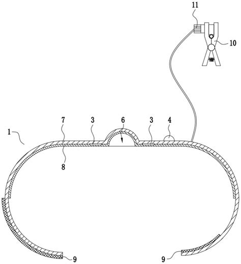 Indwelling Needle Extravasation Monitoring And Blocking Device Eureka Patsnap