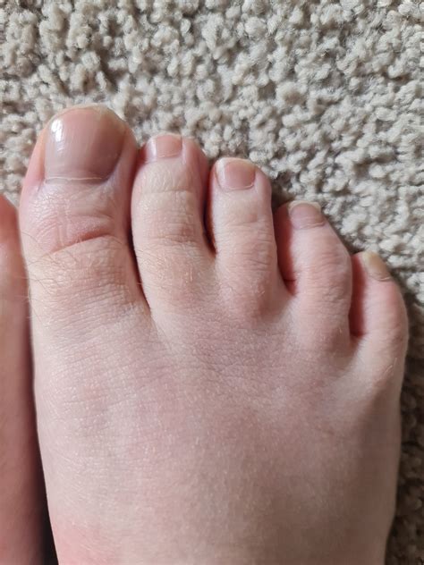 Types Of Bed Toes At Stephen Lee Blog