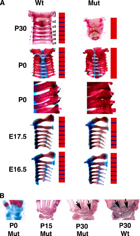Figure 2 From Filamin B Represses Chondrocyte Hypertrophy In A Runx2