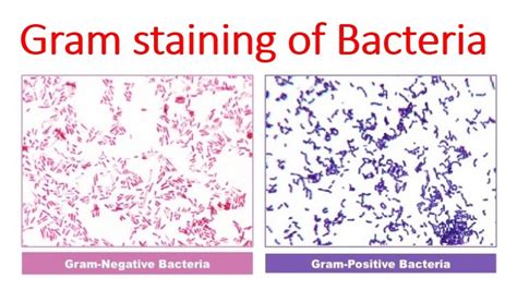 Gram Staining Principle Procedure Interpretation 43 Off