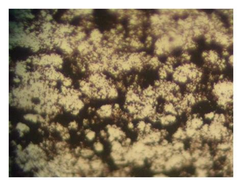 Photomicrograph Of Smear Stained With Fontana Masson ×100 Download