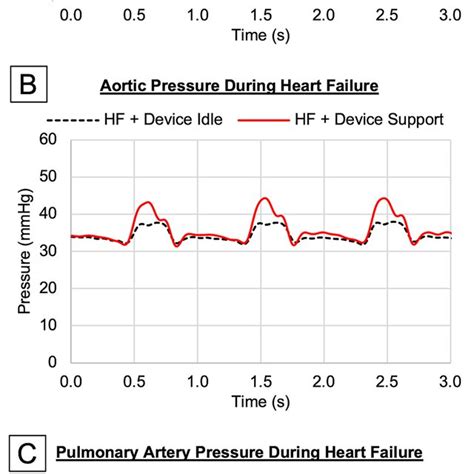 Representative Waveforms To Demonstrate The Instantaneous Hemodynamic