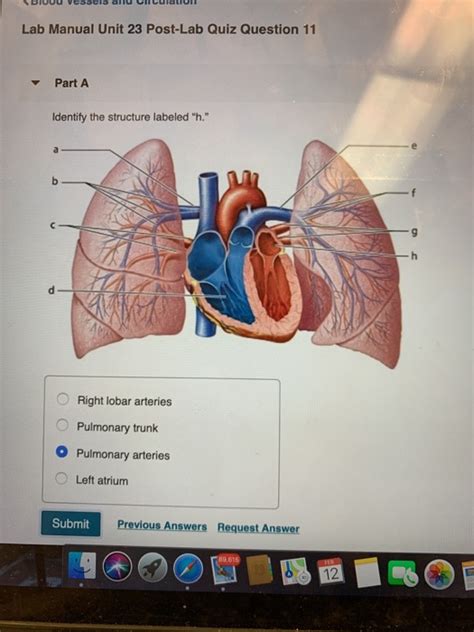 Solved Lab Manual Unit Post Lab Quiz Question Part Chegg