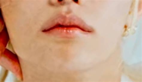 시술 수술 질문 입술필러로 모양 바 강남언니 1등 성형수술and피부시술 정보앱