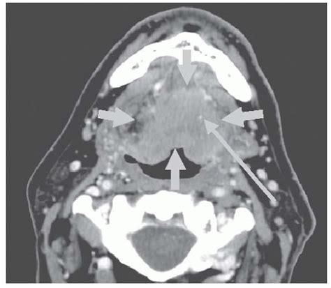 Radiologic Imaging Concerns Oncohema Key