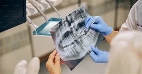 치과 진료소에서 치열 교정 의사와 대화를 나누는 동안 치아 고객의 사진 초상화를 닫습니다 사진 Unsplash의 치통 이미지