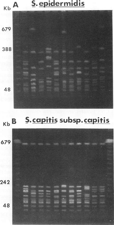 Pfge Of Smai Generated Restriction Patterns Of The Chromosome Of Download Scientific Diagram