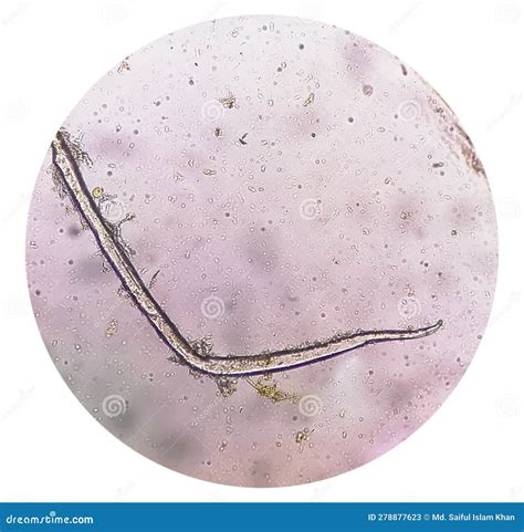 Microscopic Examination Of Human Stool Showing Unknown Parasite Stock Image Image Of