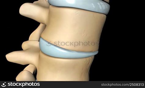 Spinal Cord Normal Intervertebral Disc 3d Illustration Spinal Cord Normal Intervertebral