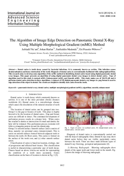 Pdf The Algorithm Of Image Edge Detection On Panoramic Dental X Ray