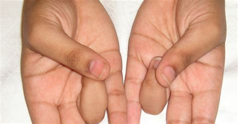 Healthy Tips For You: Mudras for healing-Part-6-Surya Mudra