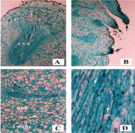 Light Microscope Micrograph Of Root Cross Section Of High Susceptible