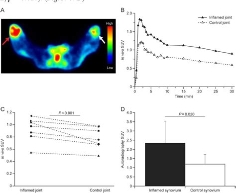 Figure 1 From Vascular Adhesion Protein 1 As In Vivo Target For Imaging Of Leukocyte