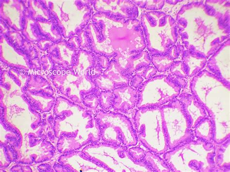 Microscope World Blog Prostate Gland Under Microscope