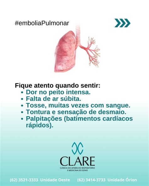 Raio X De Embolia Pulmonar Bases RadiolÓgicas Das DoenÇas TorÁcicas