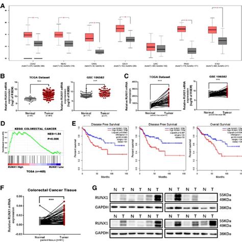 Runx1 Promotes Colorectal Cancer Progression Via Runx1 Wntβ Catenin Runx1 Promotes Colorectal Cancer Progression Via Runx1 Wntβ Catenin