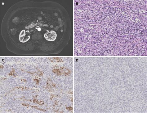Clinical Imaging And Pathological Features A Magnetic Resonance Download Scientific Diagram