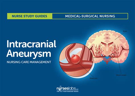 Intracranial Cerebral Aneurysm Nursing Care Management And Study Guide