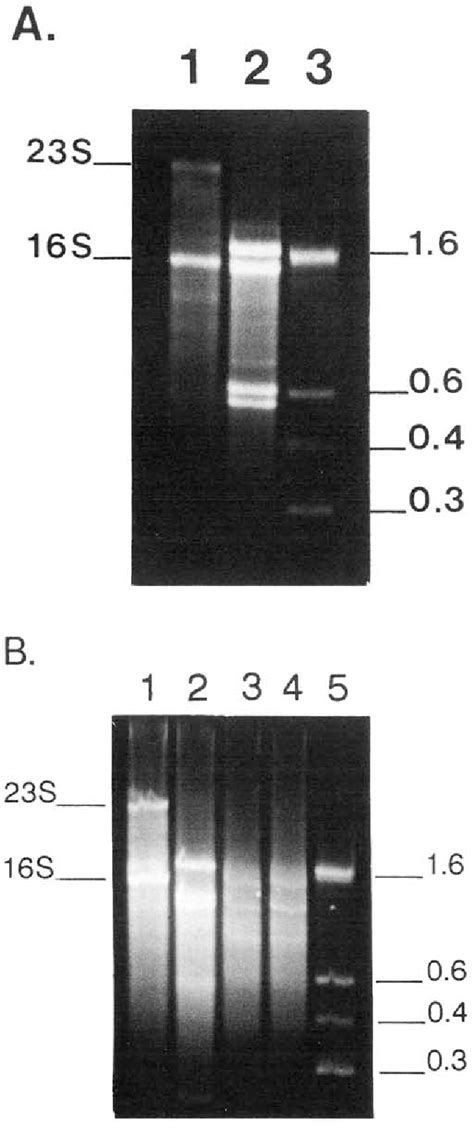 Figure 1 From Atypical Structure Of The 23s Ribosomal Rna Molecule In Certain Oral Bacteria