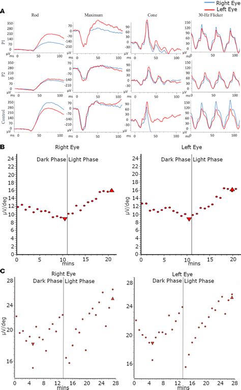 Electrooculogram And Full Field Electroretinogram Testing Results From
