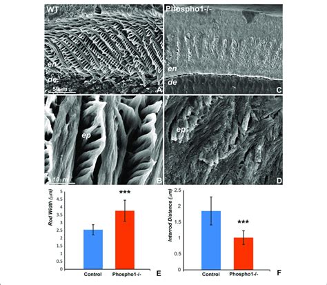 Loss Of Enamel Prism Structure And Crystal Organization In Phospho1 Download Scientific