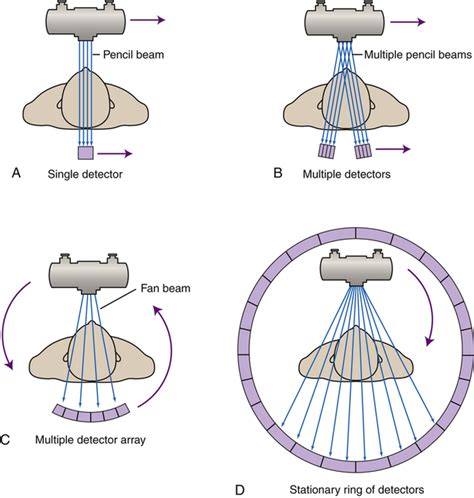 Computed Tomography Radiology Key