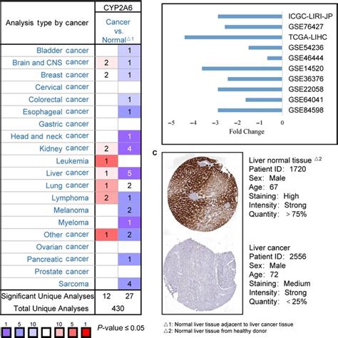 a pan‐cancer analysis of cyp2a6 expression oncomine database the