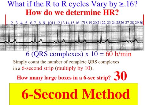 how to calculate heart rate using ecg