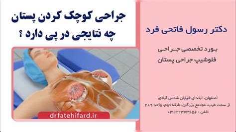 جراحی کوچک کردن پستان چه نتایجی در پی دارد ؟ کوچک کردن پستان اصفهان
