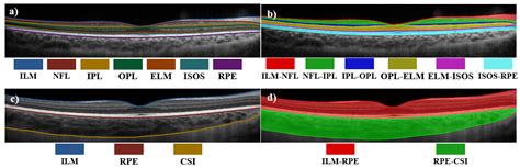 Retinal Layers Oct