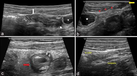 Case Reports In Clinical Radiology Current Issue