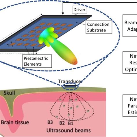 Sketch Of Intended Adaptable Setup For Networked Wireless Implantable Download Scientific