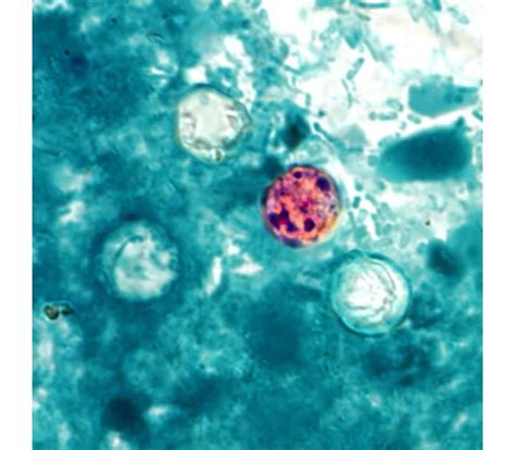 Is Cyclospora Coming For You Texas Standard