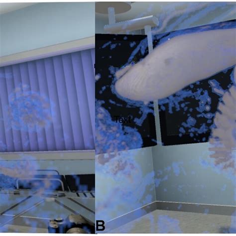The 3d Mrcp Model In The Vr Environment As Seen By The Viewer A The Download Scientific