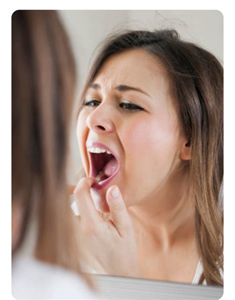 Black Teeth Stains Causes Risks And Treatment Aspen Dental