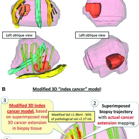Multiparametric Magnetic Resonance Imaging Mri Additional Use Of Download Scientific Diagram