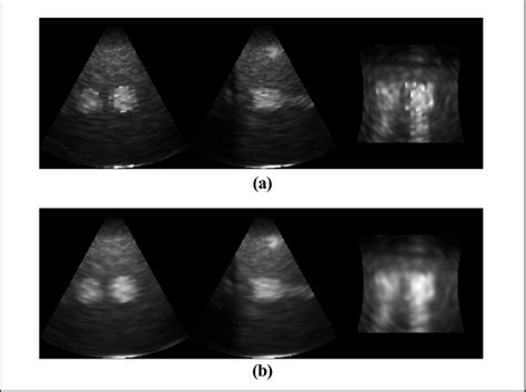 4 Anisotropic Diffusion Filtering And Scan Conversion With A Cubic Download Scientific Diagram
